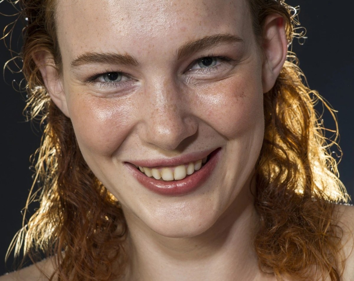 Hyperpigmentation treatments for the face